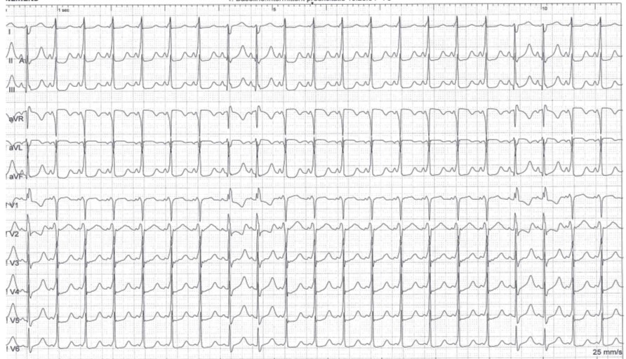 EHRA Young EP ECG Contest | Take the Quiz | QuizMaker